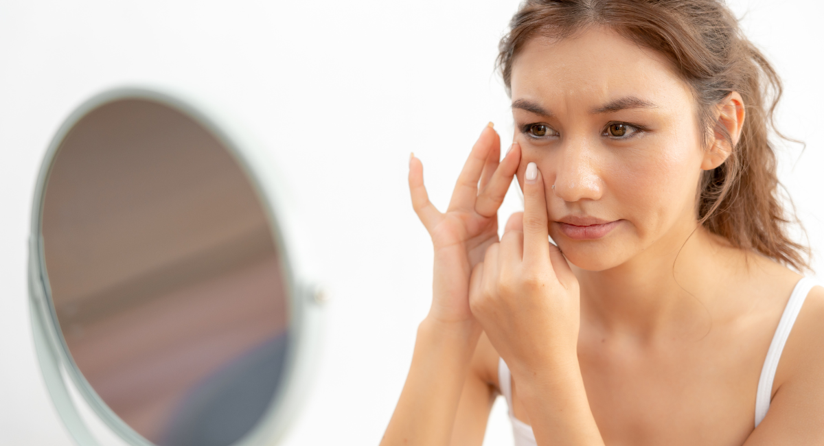 Dermatite da Sudore: Cause, Sintomi e Trattamenti Efficaci - CrossMAG